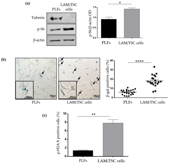 LAM Cells as Potential Drivers of Senescence in ...