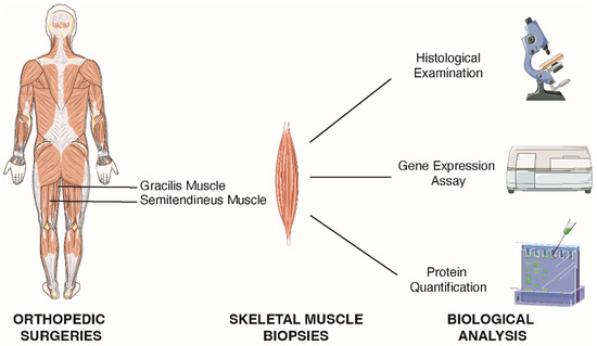 Human Sarcopenic Myoblasts Can Be Rescued by Pharmacological ...
