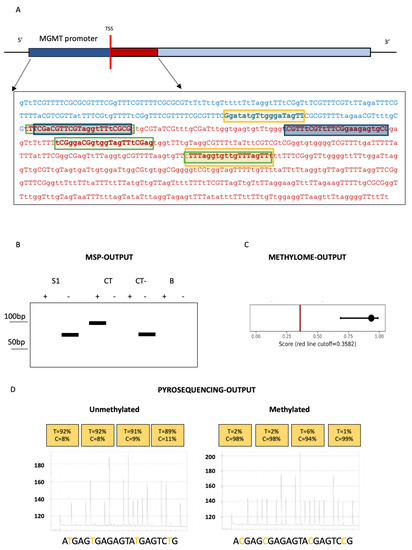 MGMT and Whole-Genome DNA Methylation Impacts on Diagnosis, Prognosis ...
