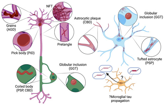 Tau as a Biomarker of Neurodegeneration