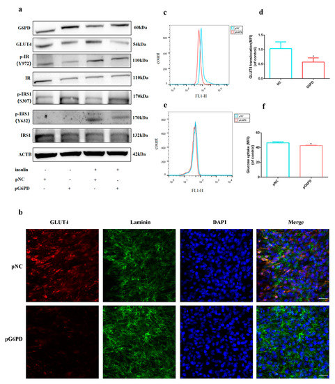 G6PD Deficiency Is Crucial for Insulin Signaling Activation in Skeletal ...