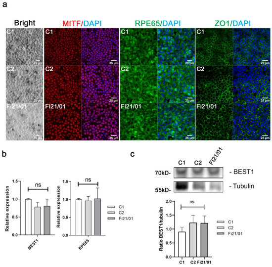 Impaired Bestrophin Channel Activity in an iPSC-RPE Model of Best ...