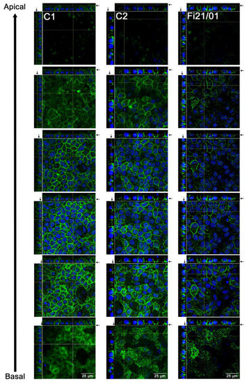 Impaired Bestrophin Channel Activity in an iPSC-RPE Model of Best ...