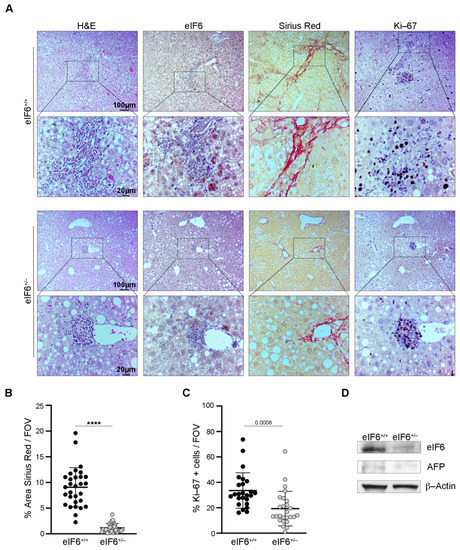 Inhibition of eIF6 Activity Reduces Hepatocellular Carcinoma Growth: An ...