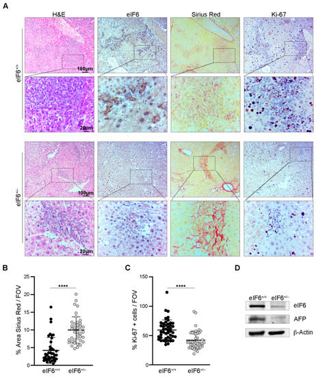 Inhibition of eIF6 Activity Reduces Hepatocellular Carcinoma Growth: An ...