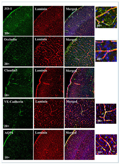 Glyoxal Fixation Is Optimal for Immunostaining of Brain Vessels ...