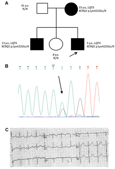 Disruption of a Conservative Motif in the C-Terminal Loop of the KCNQ1 ...