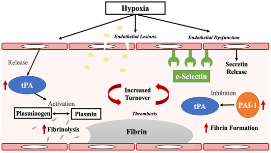 Proteomic Biomarkers of the Apnea Hypopnea Index and Obstructive Sleep ...