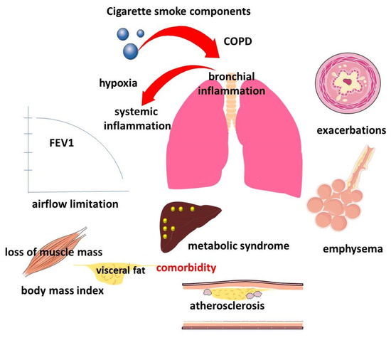 High-Density Lipoproteins: A Role in Inflammation in COPD