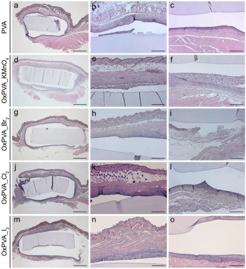 Biomaterials for Regenerative Medicine in Italy: Brief State of the Art ...