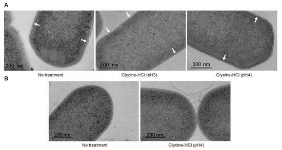 Specific Isolation of Clostridium botulinum Group I Cells by Phage ...