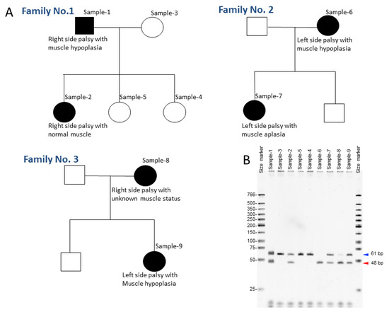 IJMS | Special Issue : State-of-the-Art Molecular Genetics in Japan