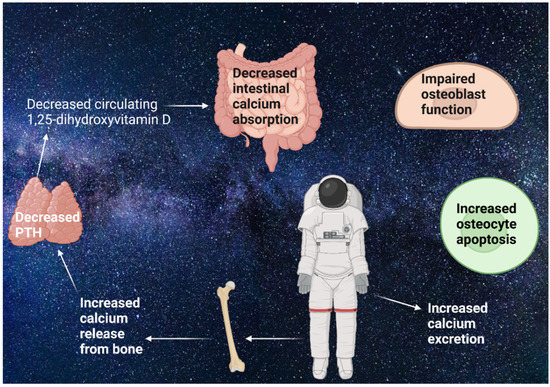 Microgravity-Related Changes in Bone Density and Treatment Options: A ...