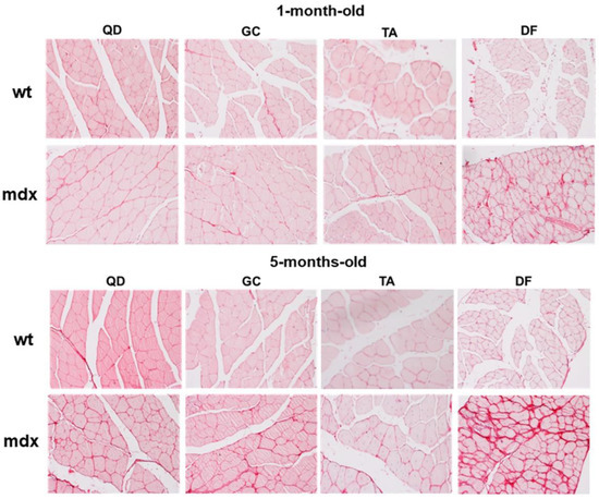 Characterisation of Progressive Skeletal Muscle Fibrosis in the Mdx ...
