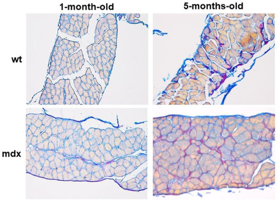 Characterisation of Progressive Skeletal Muscle Fibrosis in the Mdx ...