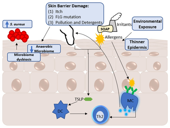 An Overview of the Latest Metabolomics Studies on Atopic Eczema with ...