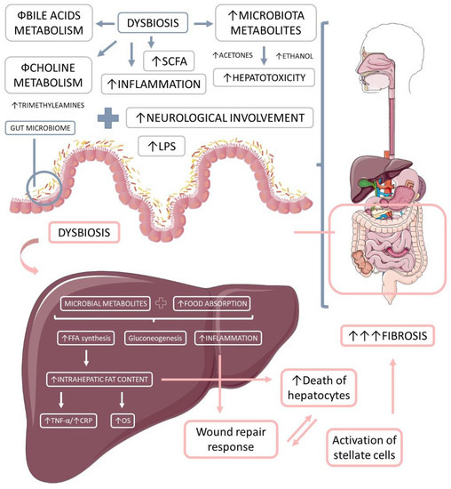 IJMS | Free Full-Text | The Effects of Probiotics, Prebiotics and Synbiotics in Non-Alcoholic ...
