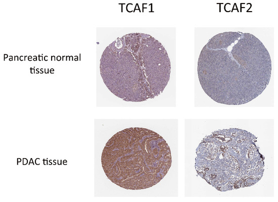 The Association between TRP Channels Expression and Clinicopathological ...
