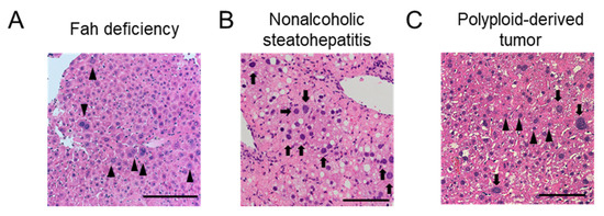 Implications of Polyploidy and Ploidy Alterations in Hepatocytes in ...