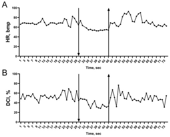Vascular Reactions of the Diving Reflex in Men and Women Carrying ...