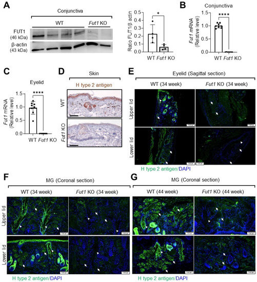 The Eyelid Meibomian Gland Deficiency in Fucosyltransferase 1 Knockout Mice