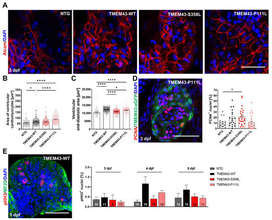 Altered Expression of TMEM43 Causes Abnormal Cardiac Structure and ...