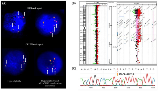 Characterization of Philadelphia-like Pre-B Acute Lymphoblastic ...