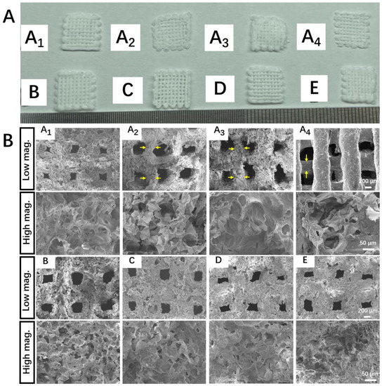 Cryogenic 3D Printing of w/o Pickering Emulsions Containing Bifunctional Drugs for Producing ...