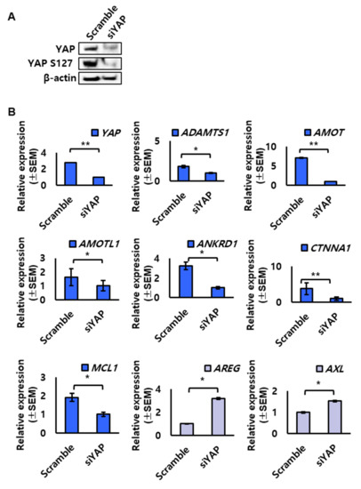Estrogen Regulates the Expression and Localization of YAP in the Uterus ...