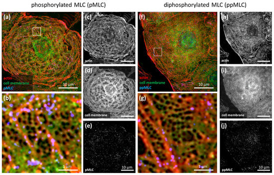 Tuning of Liver Sieve: The Interplay between Actin and Myosin ...