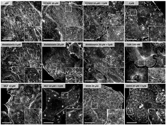 Tuning of Liver Sieve: The Interplay between Actin and Myosin ...