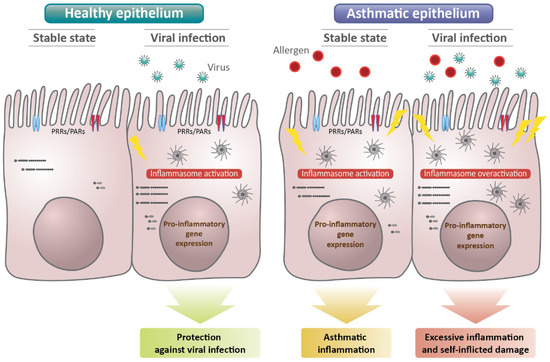 IJMS | Free Full-Text | Viral Infection and Airway Epithelial Immunity in Asthma