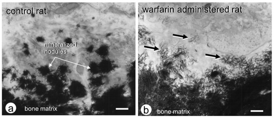 Matrix Vesicle-Mediated Mineralization and Osteocytic Regulation of ...