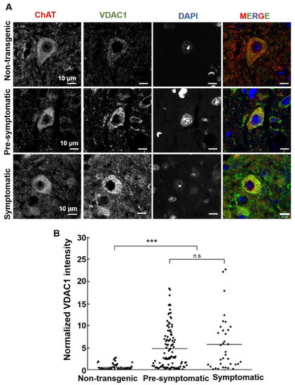 IJMS | Free Full-Text | Targeting the Mitochondrial Protein VDAC1 as a ...