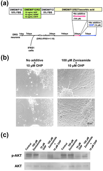 Pretreatment with Zonisamide Mitigates Oxaliplatin-Induced Toxicity in ...