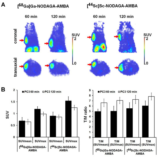 PET Probes for Preclinical Imaging of GRPR-Positive Prostate Cancer ...