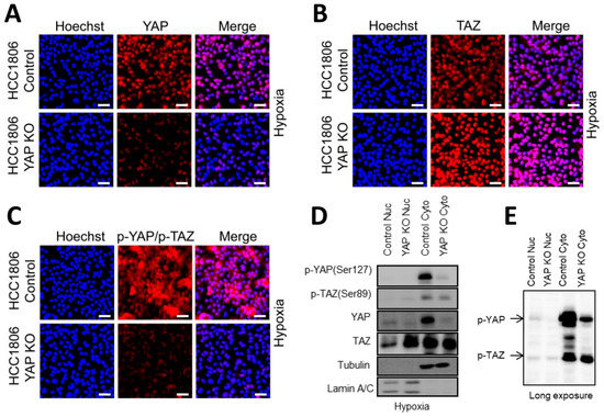 Hypoxia Triggers TAZ Phosphorylation in Basal A Triple Negative Breast ...