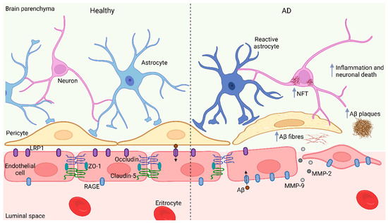 The Impairment of Blood-Brain Barrier in Alzheimer’s Disease ...
