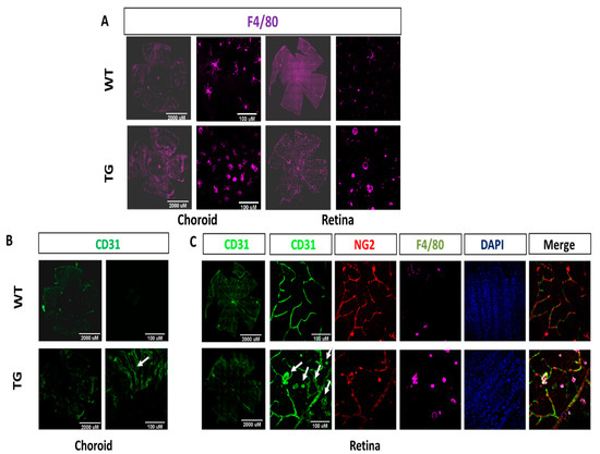 HTRA1 Regulates Subclinical Inflammation and Activates Proangiogenic ...