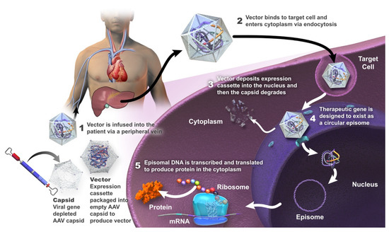 The Arrival of Gene Therapy for Patients with Hemophilia A