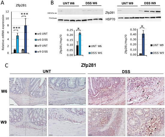 ZNF281 Promotes Colon Fibroblast Activation in TGFβ1-Induced Gut Fibrosis