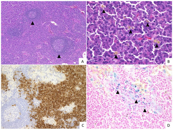 Idiopathic Plasmacytic Lymphadenopathy Forms an Independent Subtype of ...