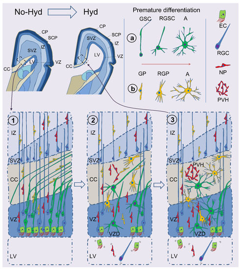 AQP4, Astrogenesis, and Hydrocephalus: A New Neurological Perspective