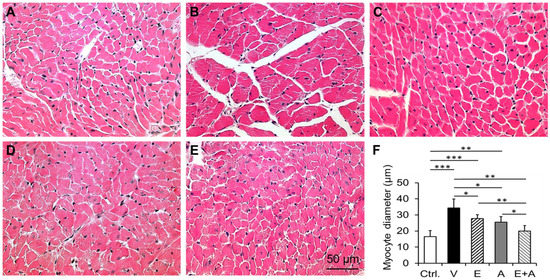 Aldehyde Dehydrogenase 2 Activator Augments the Beneficial Effects of ...