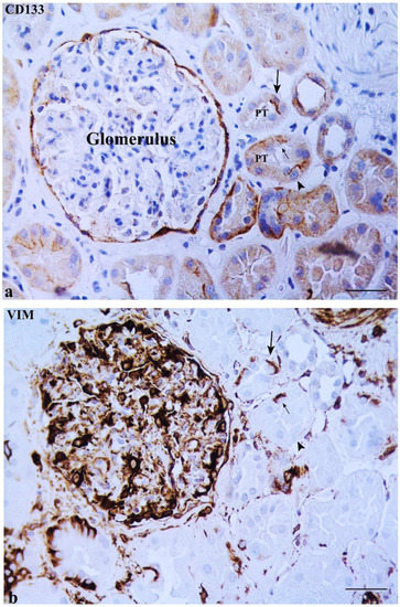 Scattered Tubular Cells Markers in Macula Densa of Normal Human Adult ...