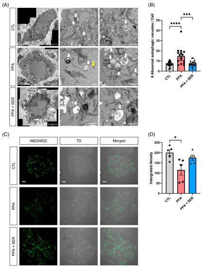 Restoration of Cathepsin D Level via L-Serine Attenuates PPA-Induced ...