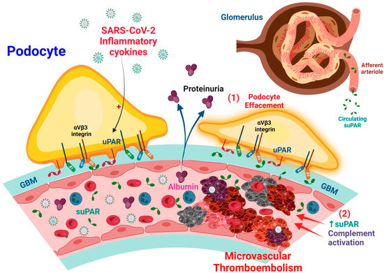 IJMS | Free Full-Text | The Perspective of Vitamin D on suPAR-Related ...