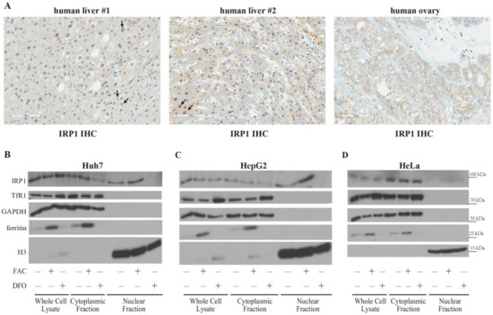 Human IRP1 Translocates to the Nucleus in a Cell-Specific and Iron ...