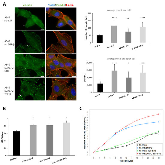 Identification of AGR2 Gene-Specific Expression Patterns Associated ...