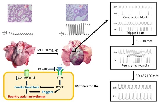 IJMS | Free Full-Text | Role of Endothelin-1 in Right Atrial ...